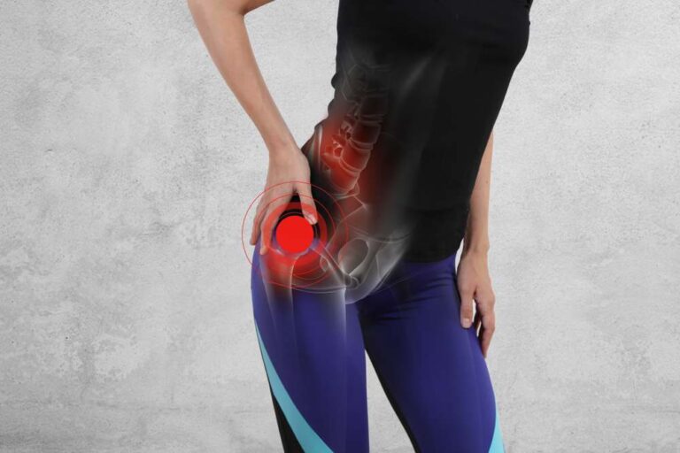What to Do When Your Hip Feels Out of Place? Causes and Cure